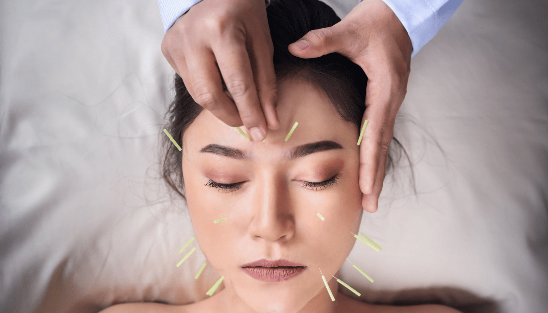 Acupuncture for TMJ, Nordic Balance